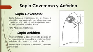 Sindrome cavitario | PPTX