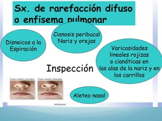 Síndrome de Rarefacción Difusa | PPT