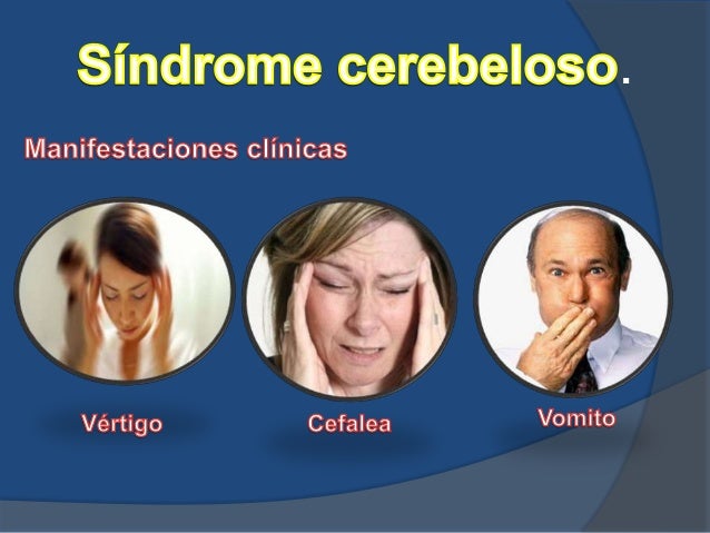 Sindrome cerebeloso.pptx dd