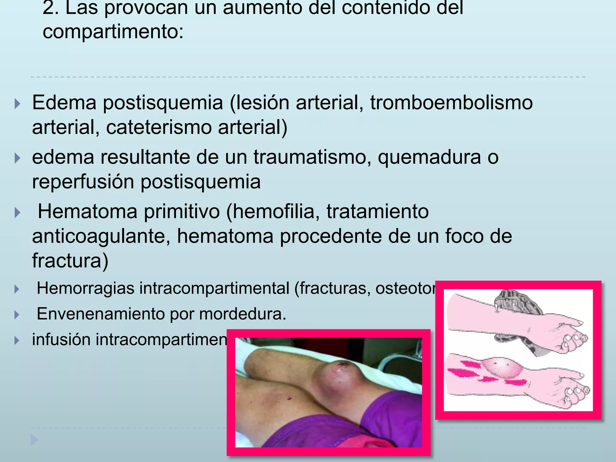 Sindrome compartimental EN TRAUMATOLOGÍA Y ORTOPEDIA | PPTX