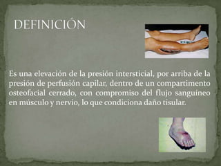 Sindrome compartimental | PPTX