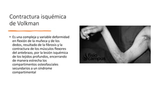 sindrome compartimental.pptx