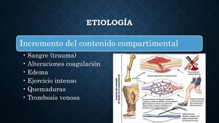 Síndrome compartimental.pptx