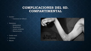 Síndrome compartimental.pptx
