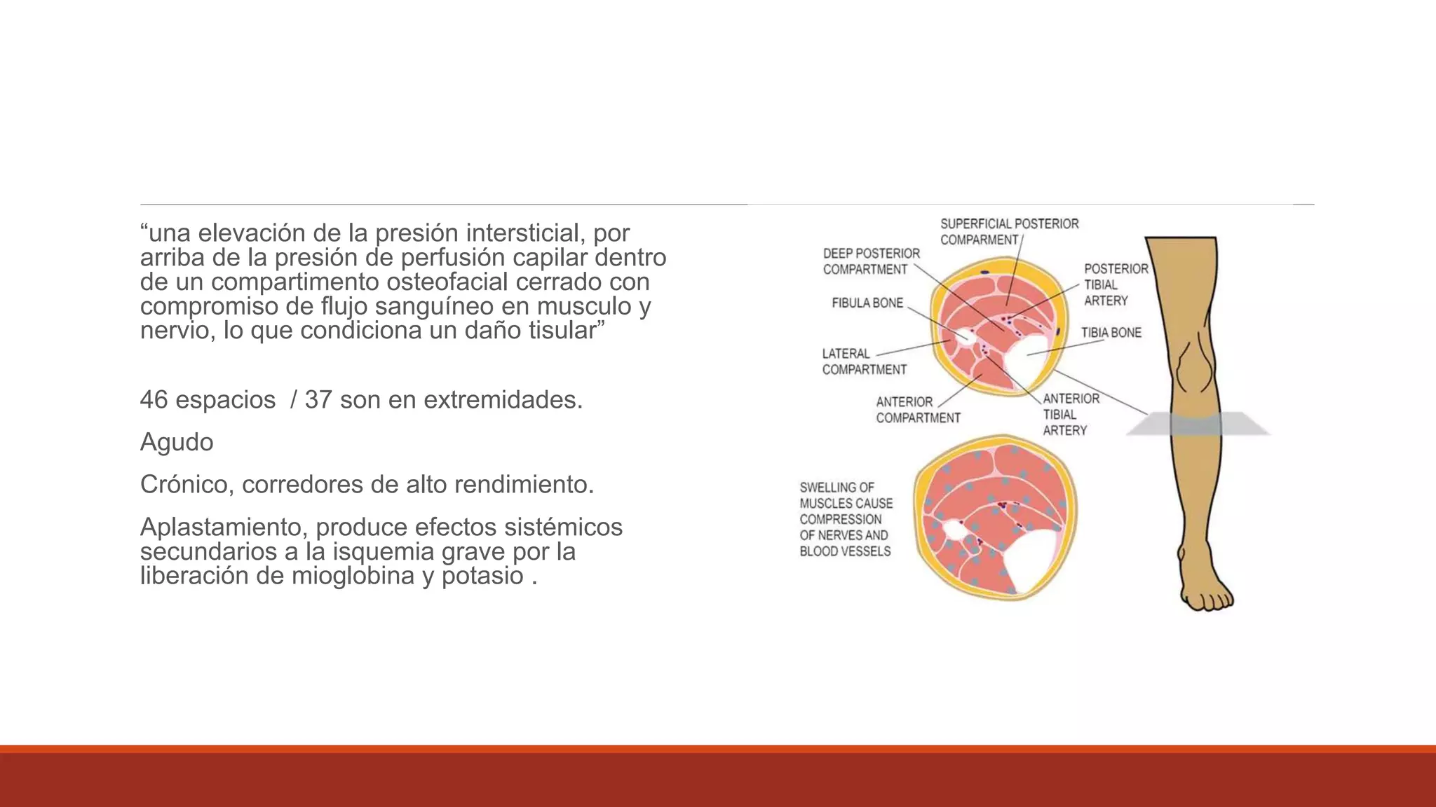 sindrome compartimental.pptx