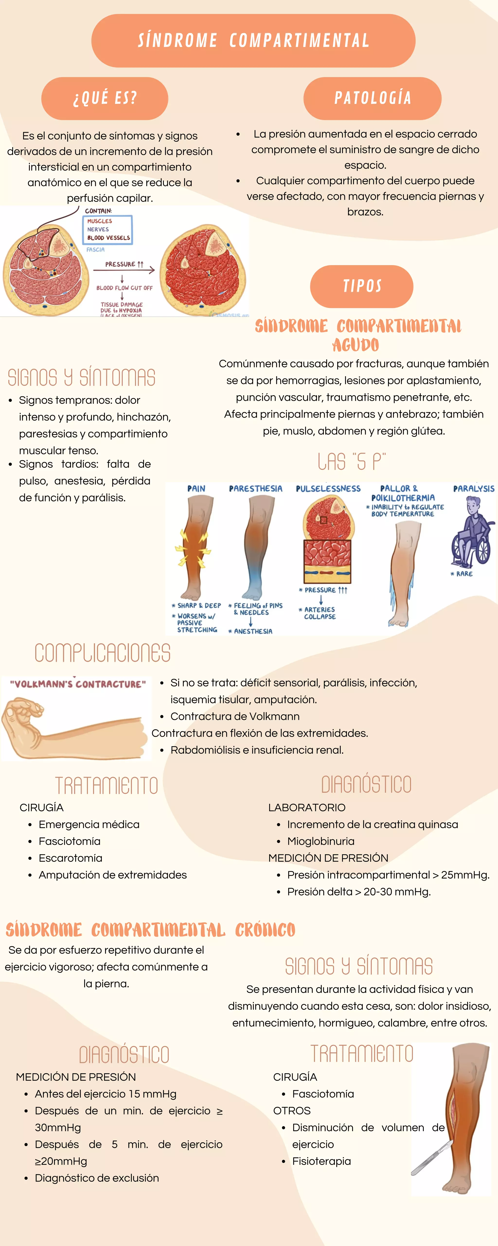 Síndrome compartimental | PDF