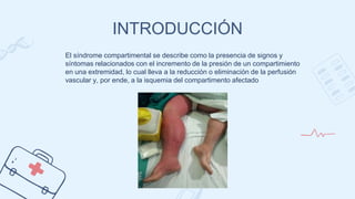 sindrome compartimental.pptx