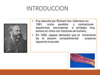sindrome compartimental.pptx