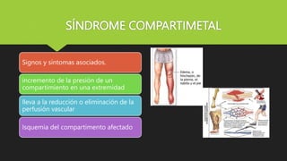 SÍNDROME COMPARTIMENTAL.pptx