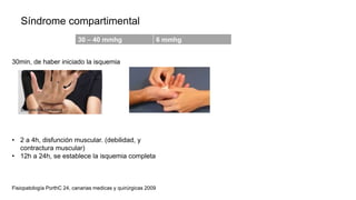 sindrome compartimental draMARIAFERNARNADA | PPTX