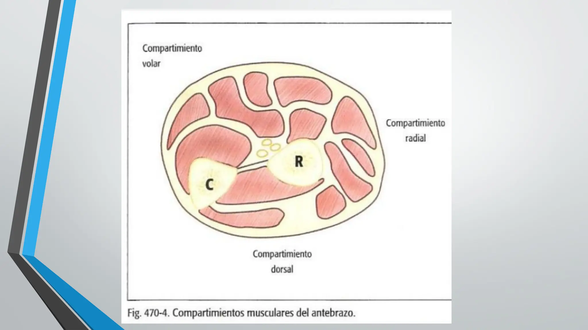 Sindrome_Compartimental concepto y tipos | PDF