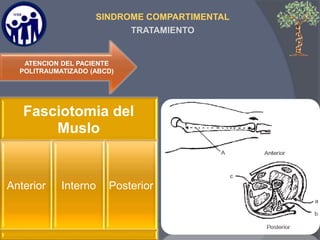 Sindrome compartimental | PPTX