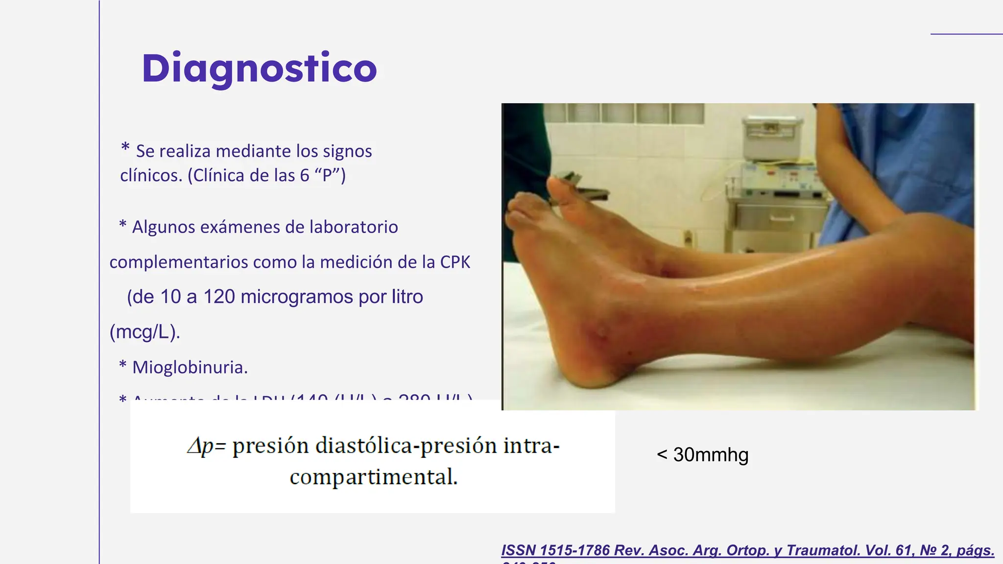 Sindrome compartimental como urgencia en traumatologia.pptx