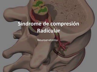 Comprehensive Overview of Radicular Compression Syndrome: Diagnosis ...