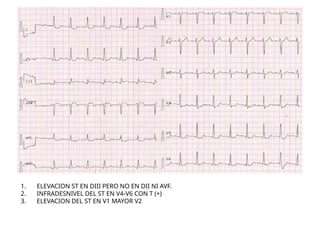 SINDROME CORONARIO AGUDO SIN ELEVACION DEL ST | PPTX