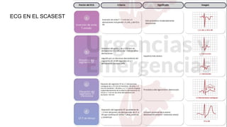 Sindrome Coronario agudo sin elevacion del st de las guias 2020 y 2023.pptx