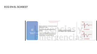 Sindrome Coronario agudo sin elevacion del st de las guias 2020 y 2023.pptx