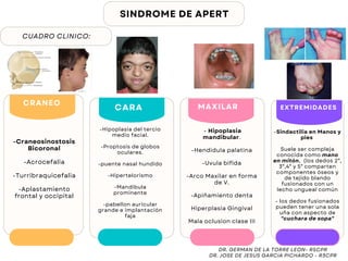 Síndrome craneofaciales compendio principales síndromes | PDF