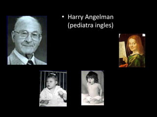 Sindrome de angelman | PPTX