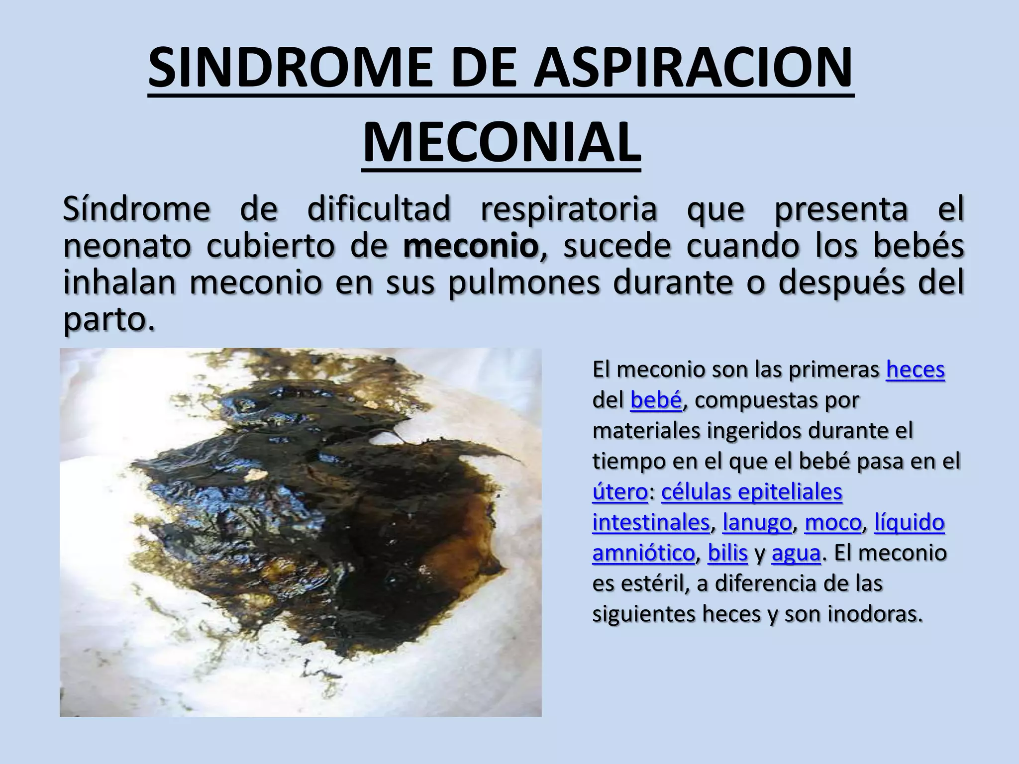 Sindrome de aspiracion meconial | PPTX