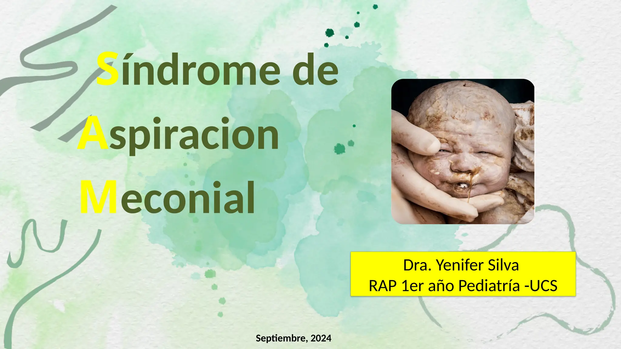 Sindrome de aspiracion Meconial en recién nacido del hospital general ...