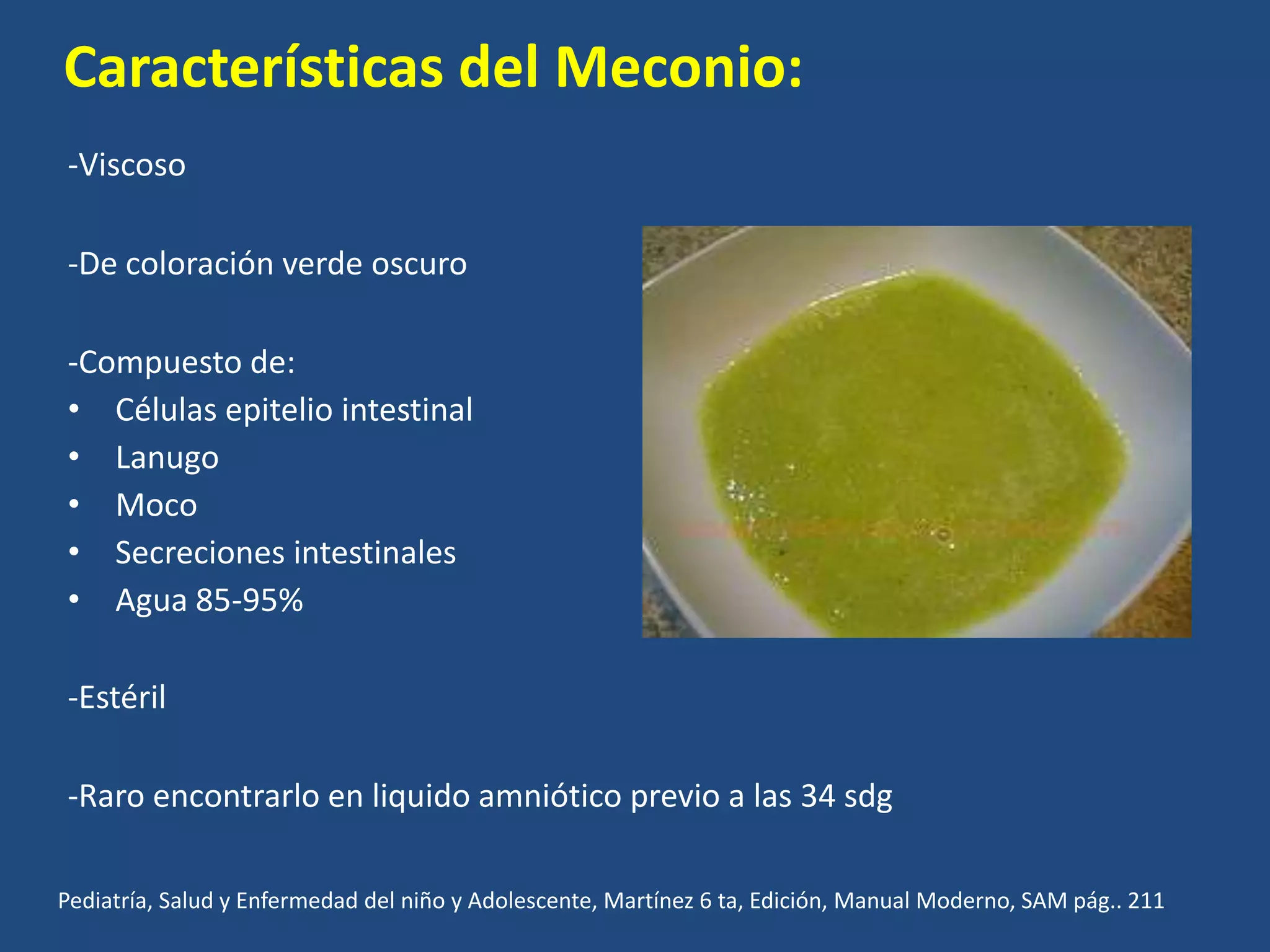Sindrome de aspiracion meconial | PPTX