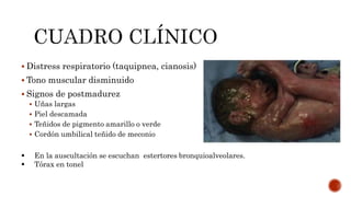 Sindrome de aspiracion meconial | PPTX