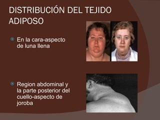 (2012-04-17)Sindrome de Cushing.ppt
