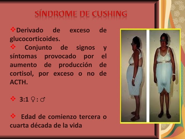 Sindrome de cushing