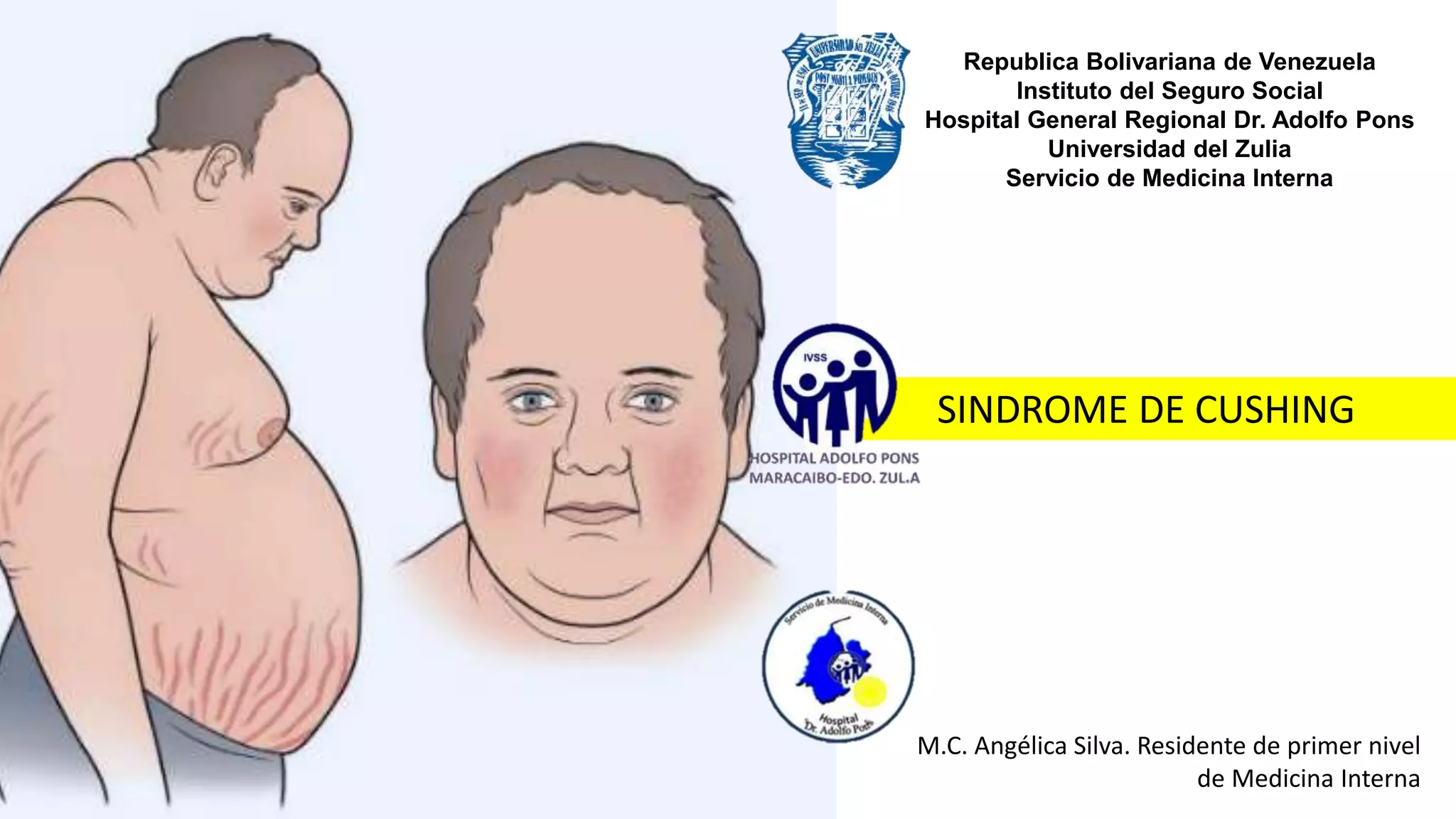 sindrome de cushing.pptx