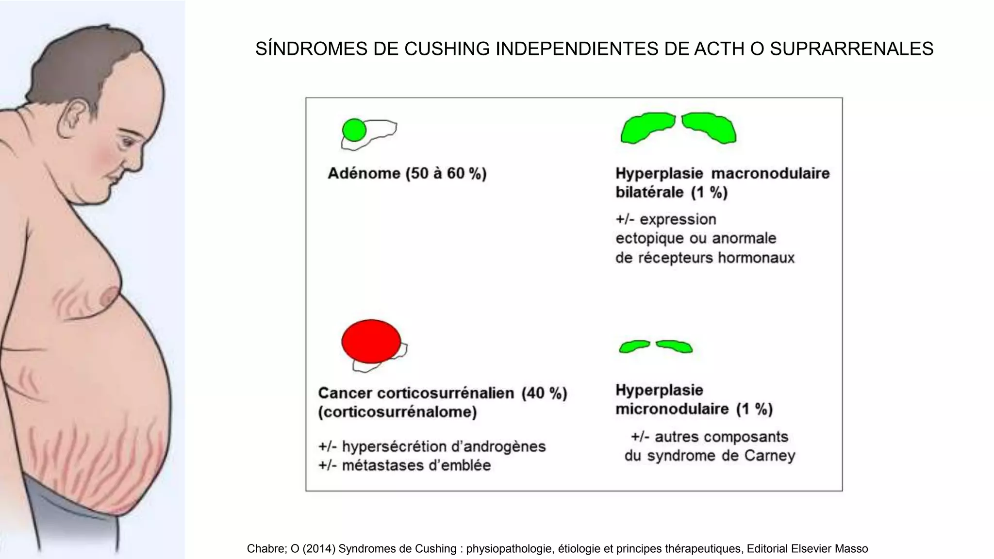 sindrome de cushing.pptx