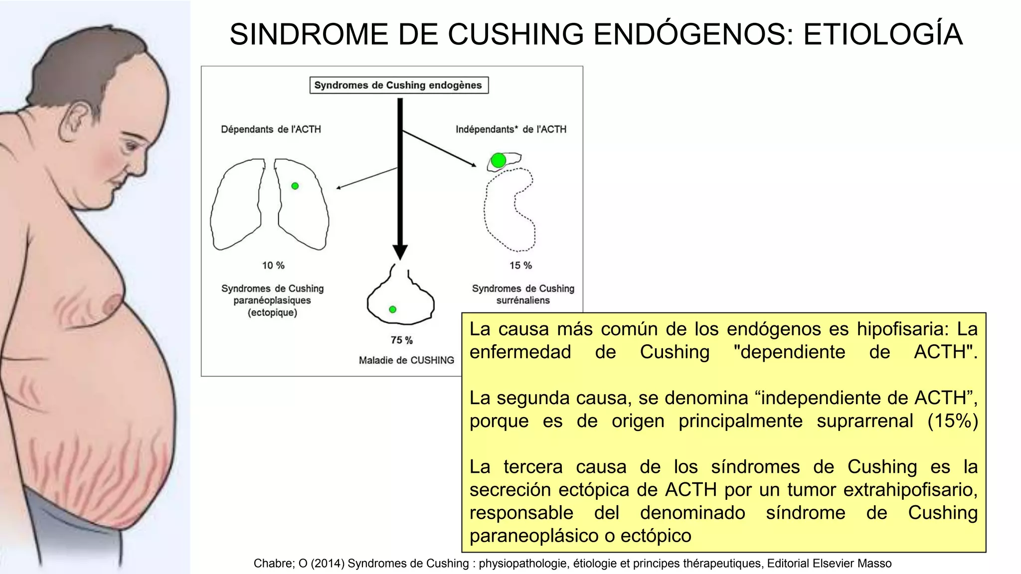 sindrome de cushing.pptx