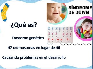 presentación sobre síndrome de Down.pptx
