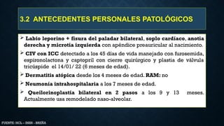 SINDROME DE DUANE BILATERAL CASO CLINICAO | PPTX