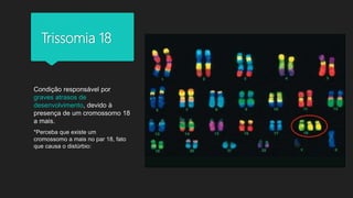 Sindrome de edwards | PPT