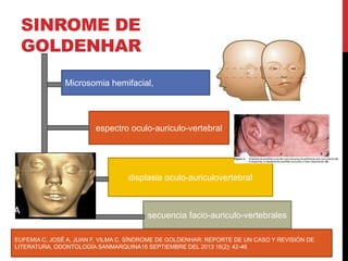 Falsedad Monetario plan de ventas displasia oculo auriculo vertebral Tomar un baño Pronunciar orden