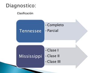 SINDROME DE HELLP.pptx