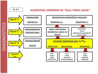 Sindrome de la silla turca vacia | PPTX