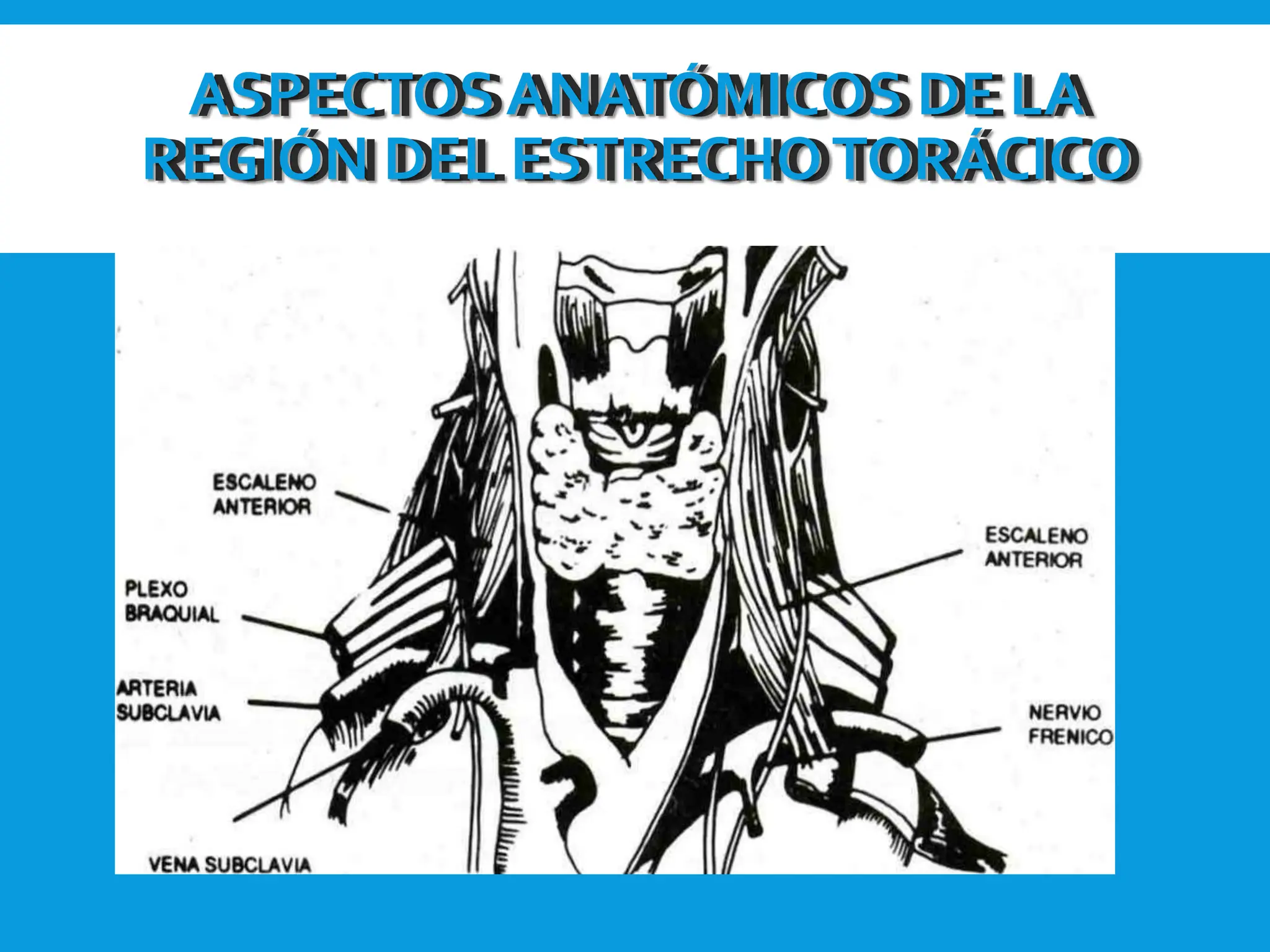 SINDROME DEL DESFILADERO TORACICO DOLOROSO | PPTX