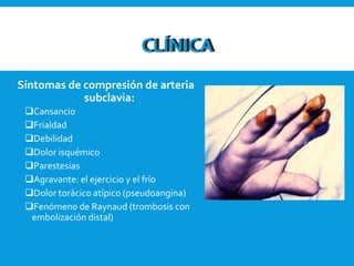 SINDROME DEL DESFILADERO TORACICO DOLOROSO | PPTX