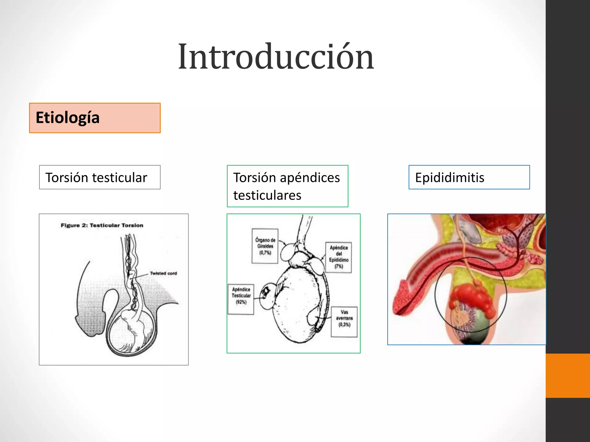 Sindrome Del Escroto Aguda Pptx Medical Health