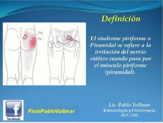 sindrome del piramidal o piriforme fisioterapia .PDF