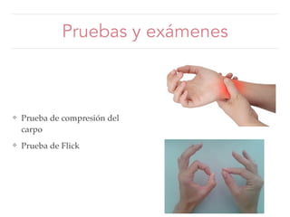 Sindrome del túnel carpiano. | PDF