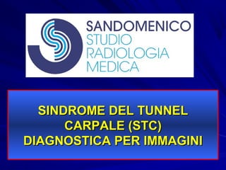 Sindrome del tunnel carpale - Diagnostica per Immagini | PPT