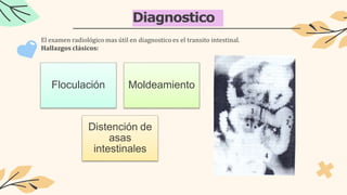 SINDROME DE MALA ABSORCION .pptx