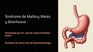 Síndrome de Mallory Weiss y Boerhaave.pdf