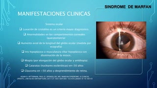 sindrome de marfan.pptx