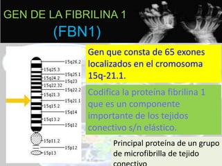Sindrome de marfan (1) | PPTX