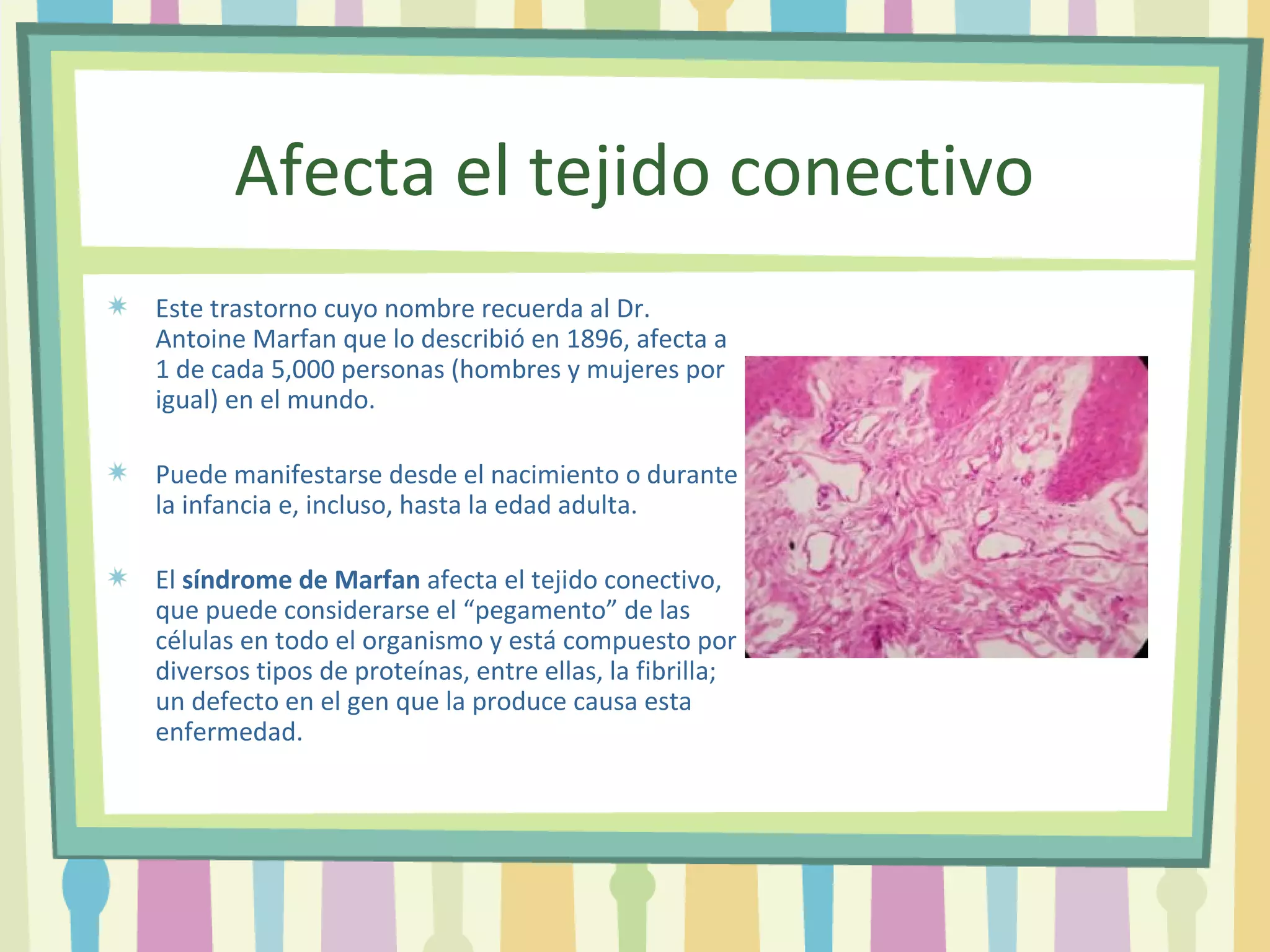 ¿Qué es el Síndrome de Marfan? | PPT