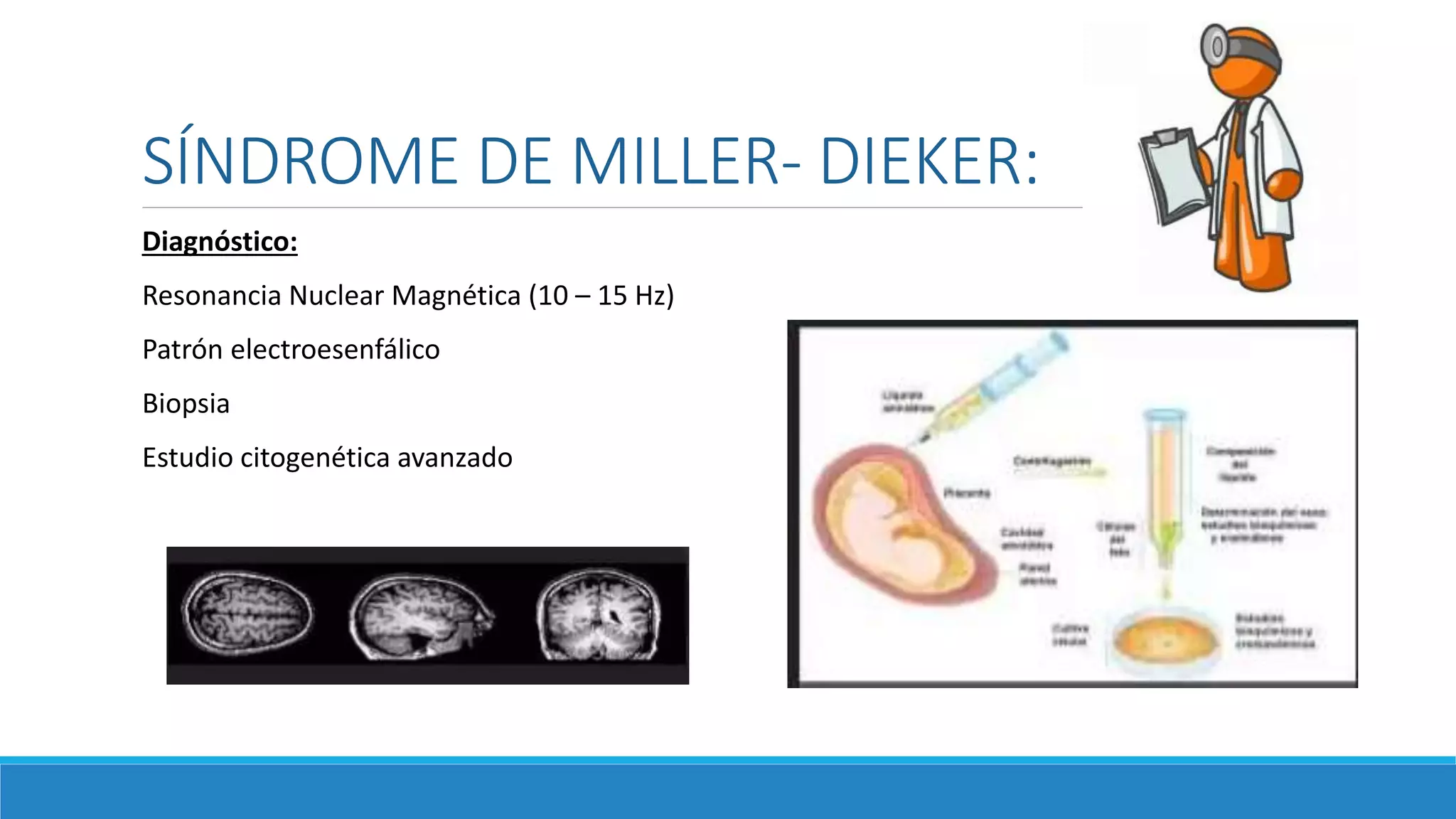 Sindrome de miller dieker | PPT